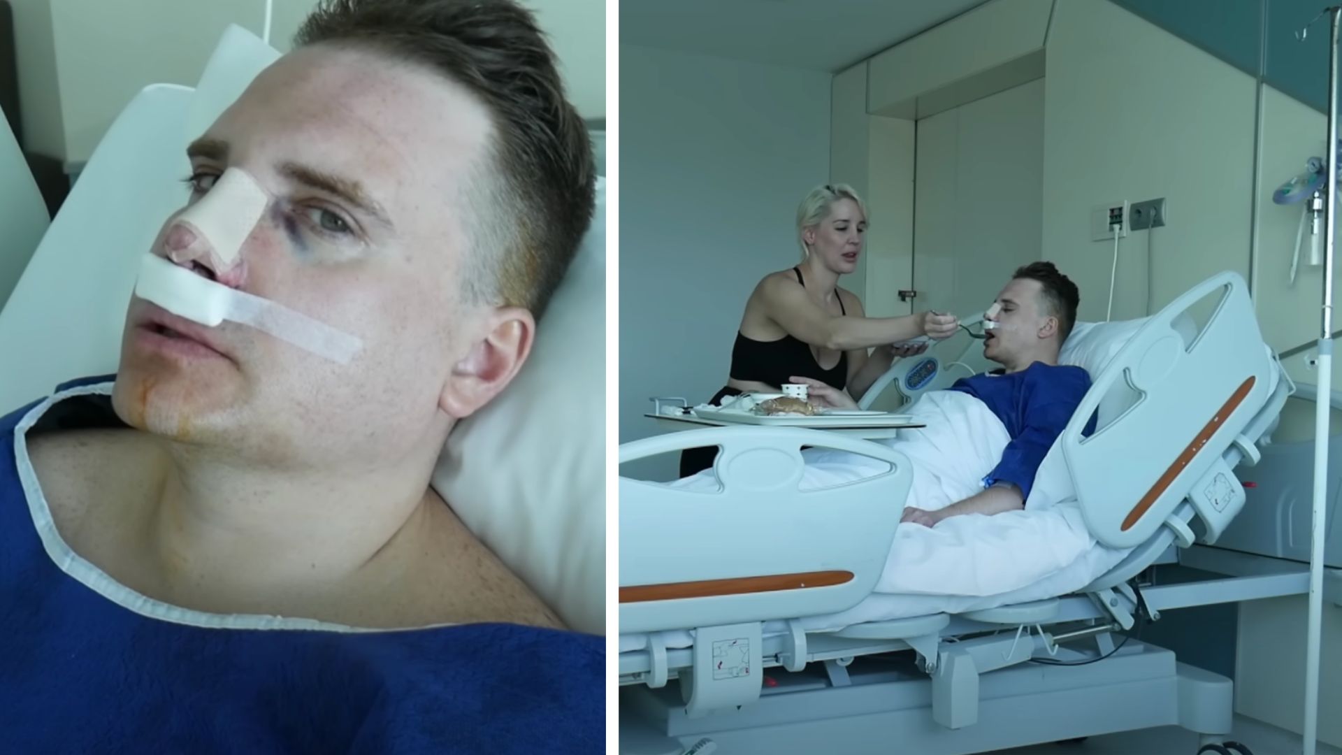Partner Lil Masti przeszedł operację plastyczną w Turcji | Kozaczek ...