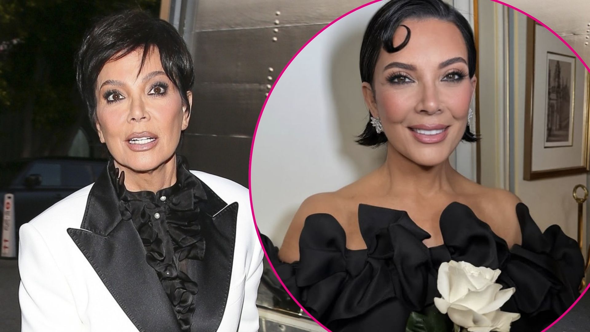 Kris Jenner wygląda młodziej niż jej córki?! Ten zabieg chirurgiczny ...