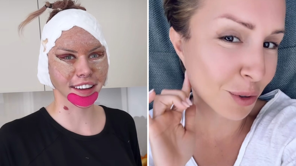 Julia von Stein pokazała twarz po liftingu wbijając szpilę: "Żeby nie było jak u Lipińskiej ...