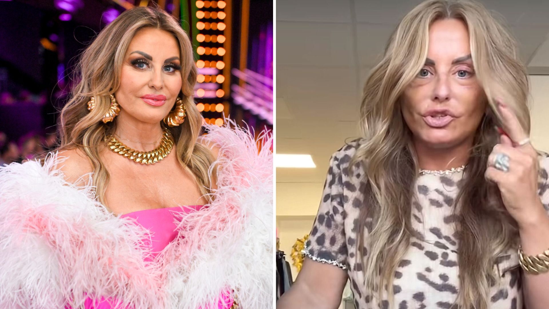 Dagmara Kaźmierska pokazała twarz tydzień po liftingu! ZDJĘCIA