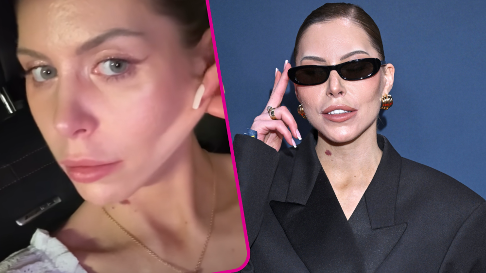 Julia von Stein zdradza, dlaczego zrobiła lifting twarzy: "Zdrowotnie ...